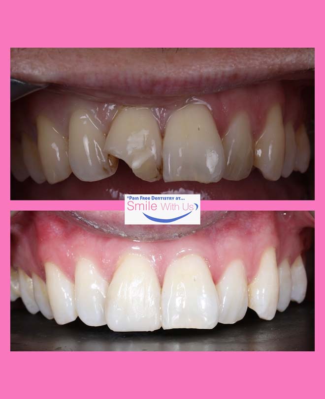 Restorative - Smile with Us | Dentist in Kidlington, England